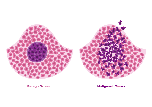 The Role of Tissue Culture Techniques in Understanding Cancer Cells ...